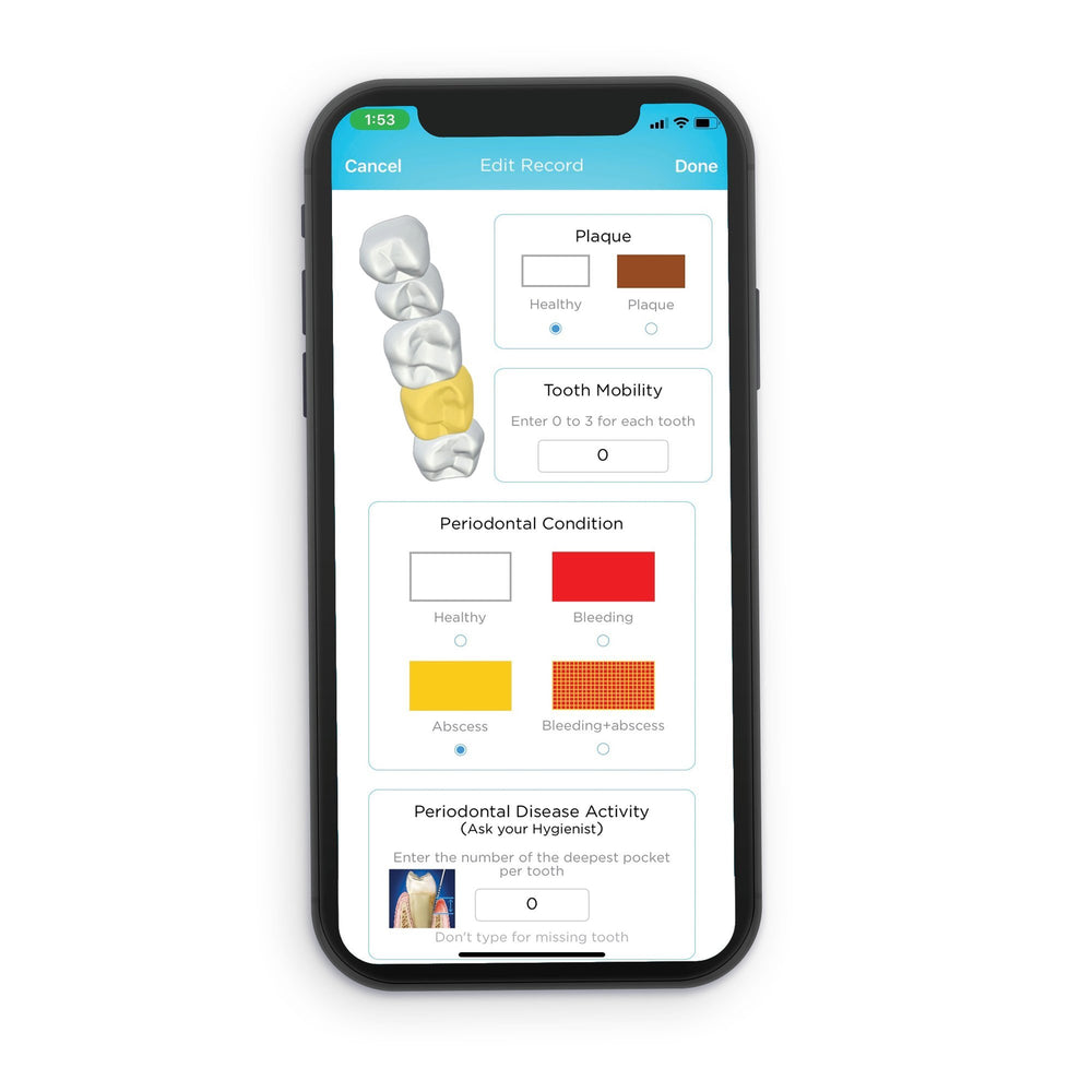 Buy BLU Smart Toothbrush with App Enabled in Onyx Black - Blu Smart ...